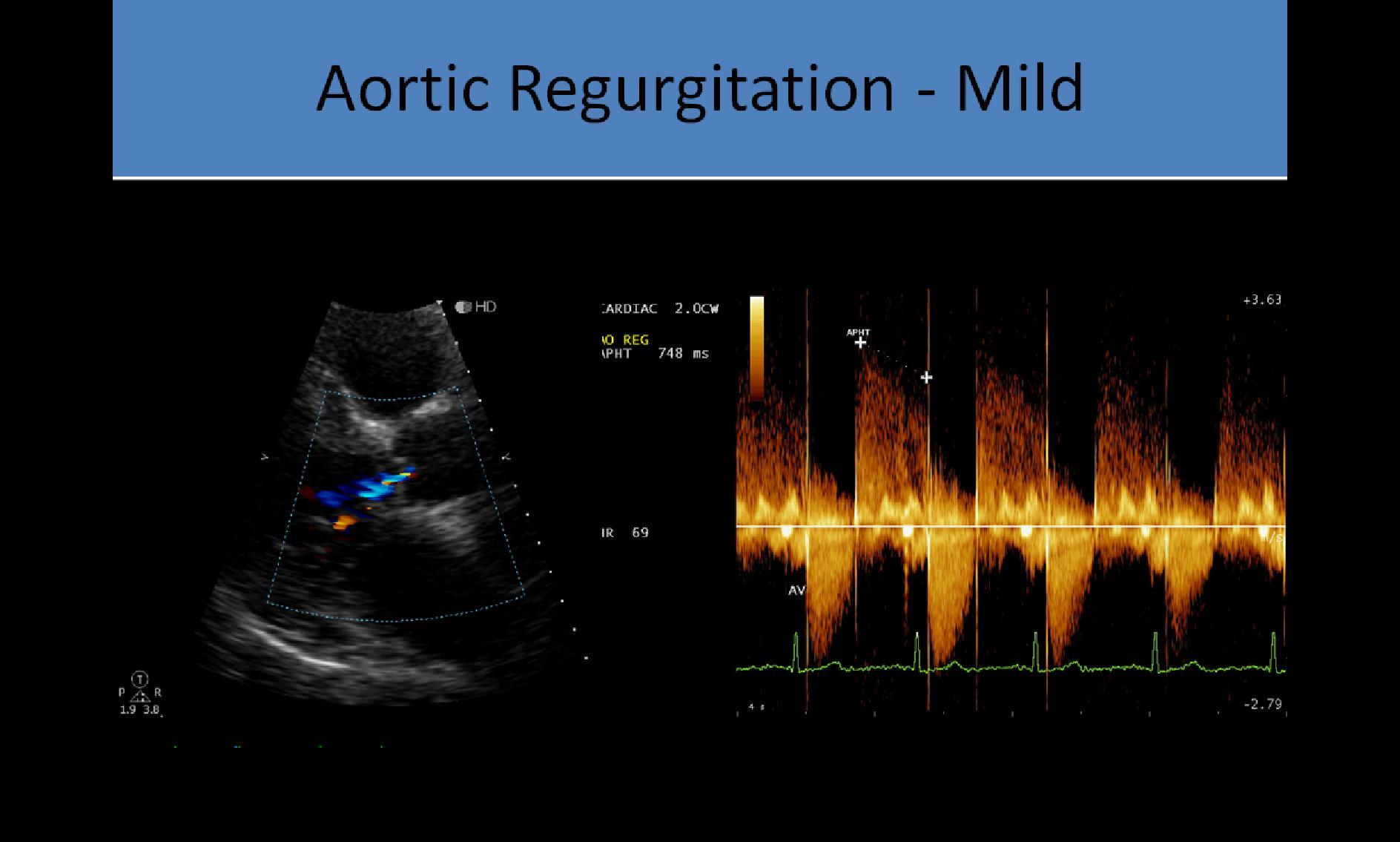 Ultrasound Registry Review Valvular Abnormalities